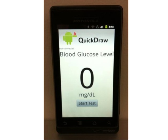 The Future of Glucose Monitoring | SIMS